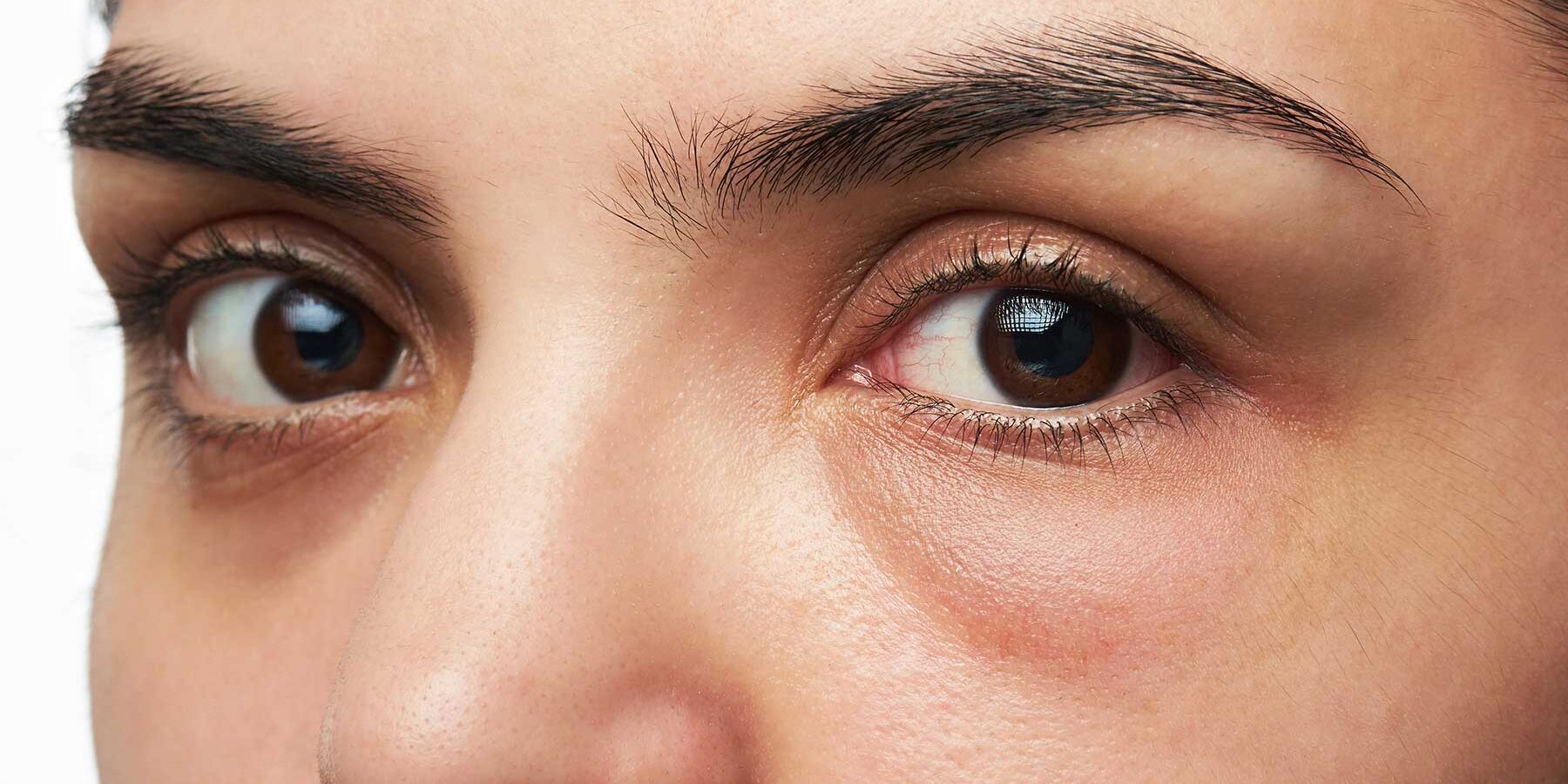 Recognizing the Signs of Cocaine Abuse | Cocaine Use Disorder